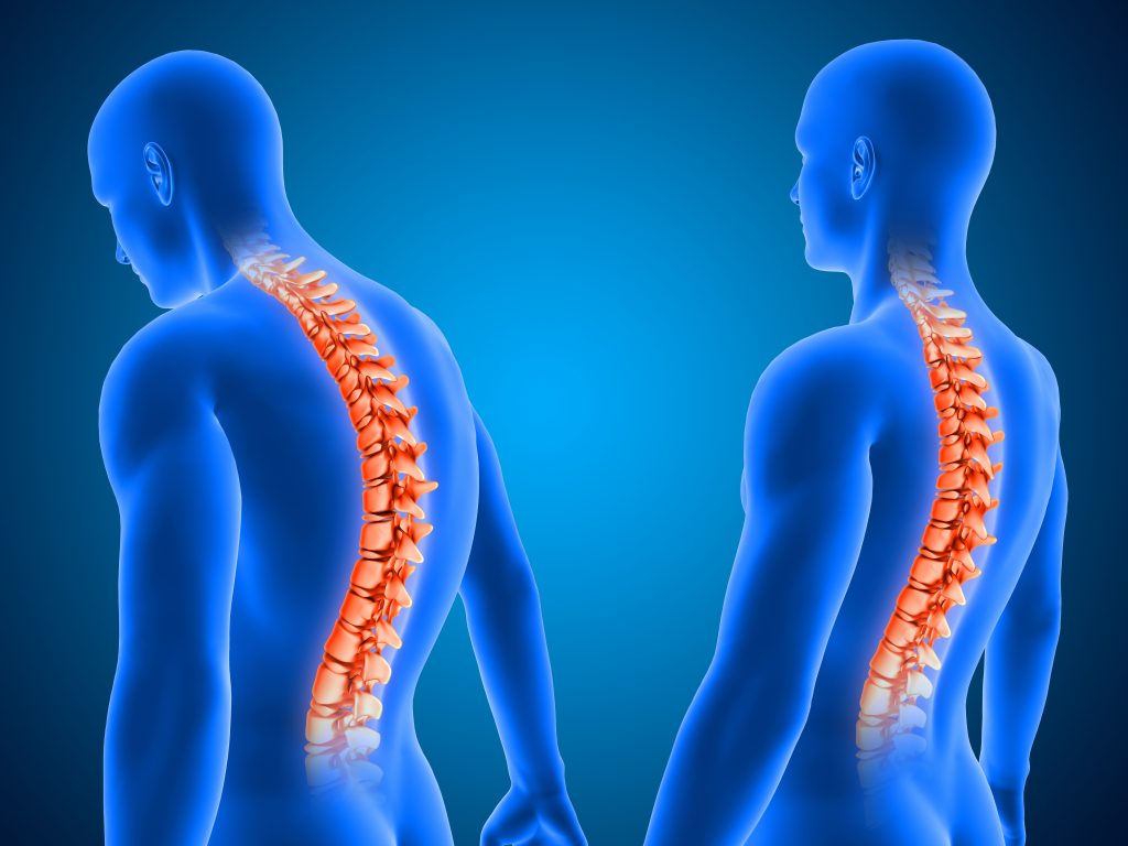 Best Spine Surgery Hospitals In India | EdhaCare