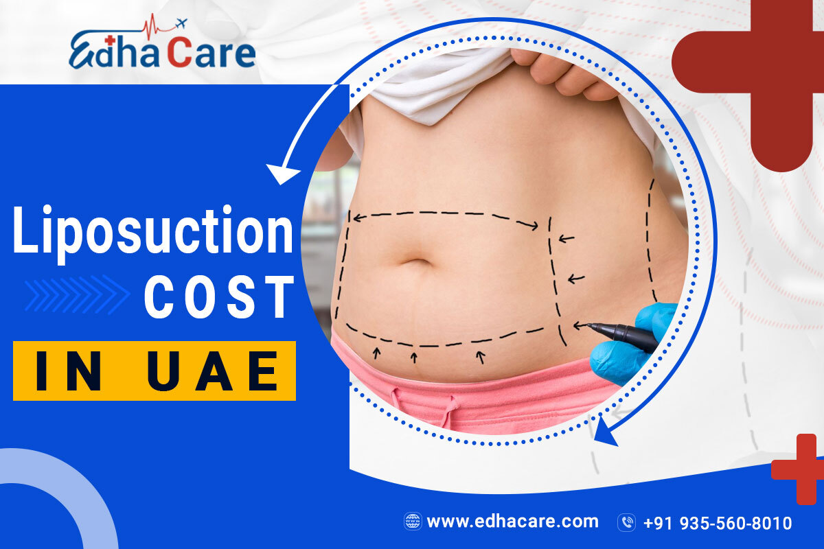 Best Doctors In India | EdhaCare