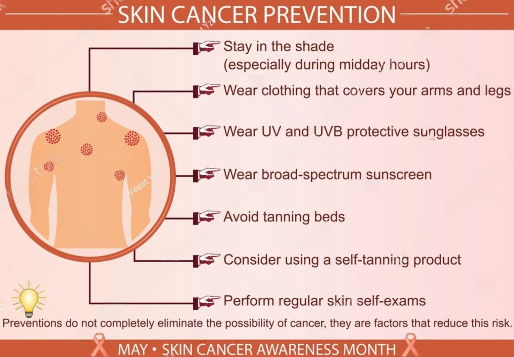 Skin Cancer Treatment Cost in India | EdhaCare
