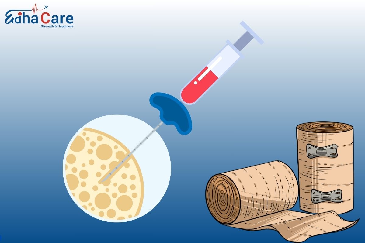 Trasplantament de medul·la òssia a l'Índia