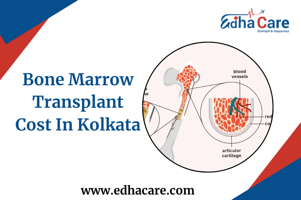 Bone Marrow Transplant Cost in Kolkata | EdhaCare