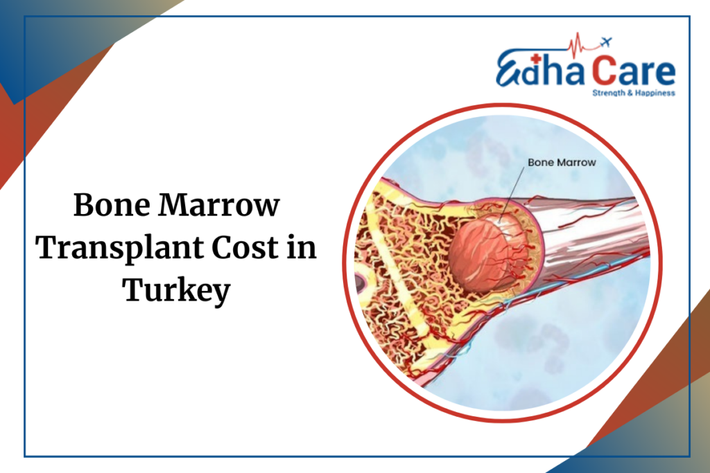 Bone Marrow Transplant Cost in Turkey | Complete Details, Review