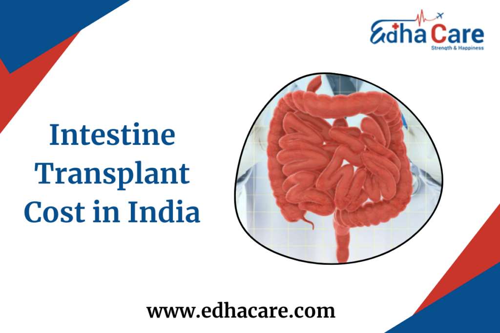 Intestine Transplant Cost in India | Hospitals & Procedure