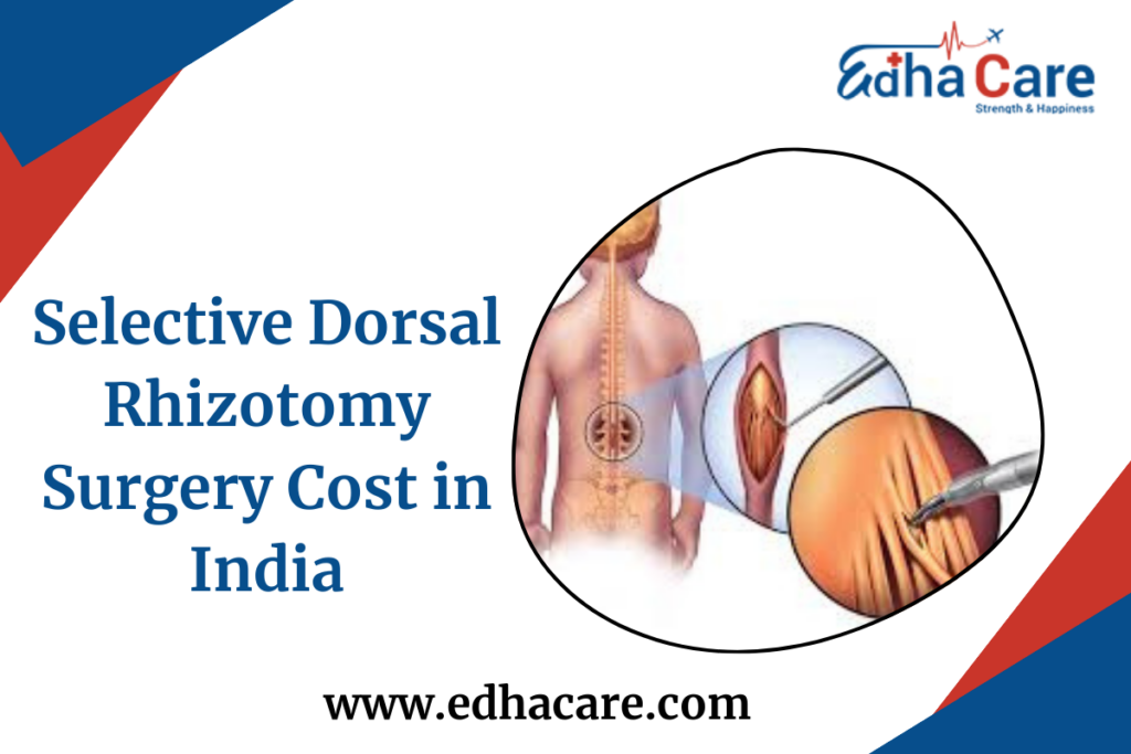 Costo de la cirugía de rizotomía dorsal selectiva en India