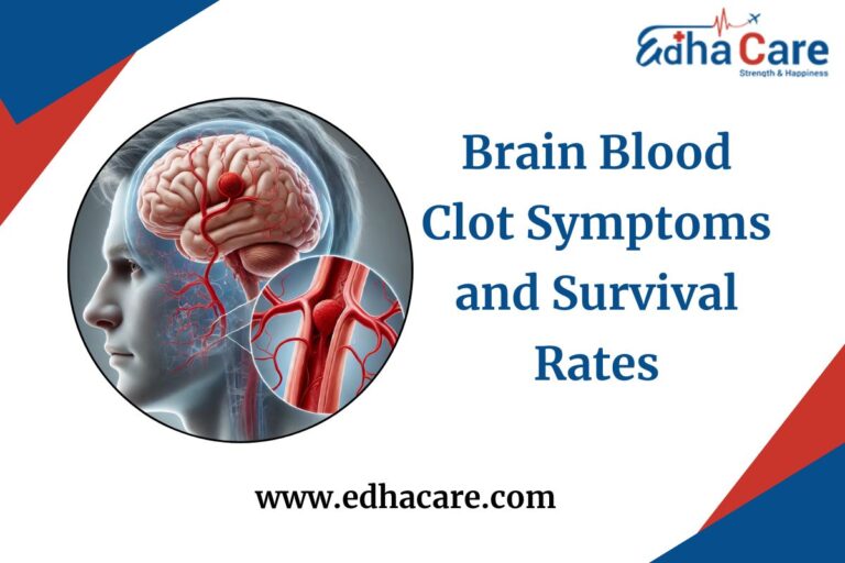 Brain Blood Clot Symptoms and Survival Rates