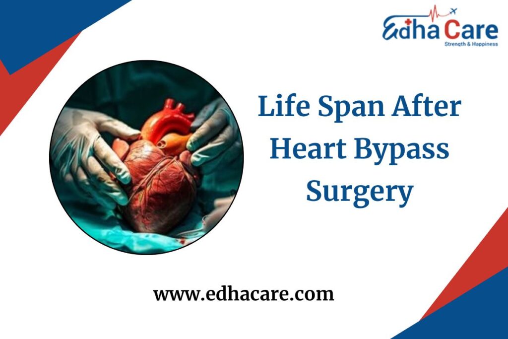 Life Span After Heart Bypass Surgery - Edhacare