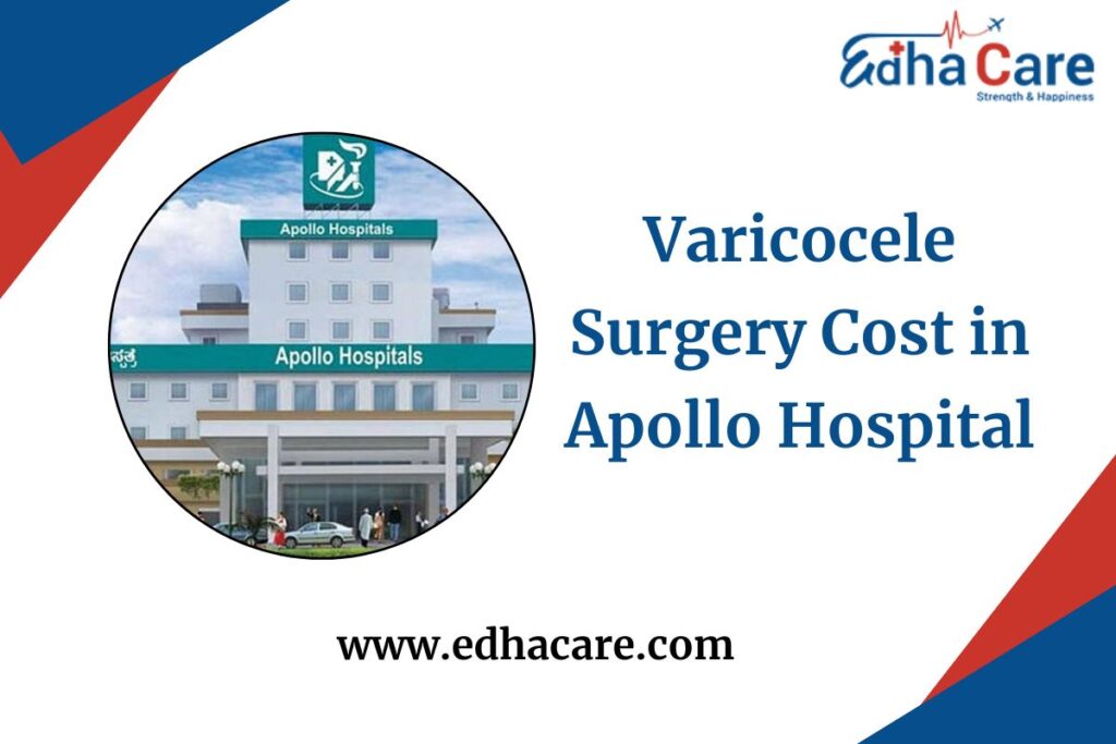 Stroški operacije varikokele v bolnišnici Apollo