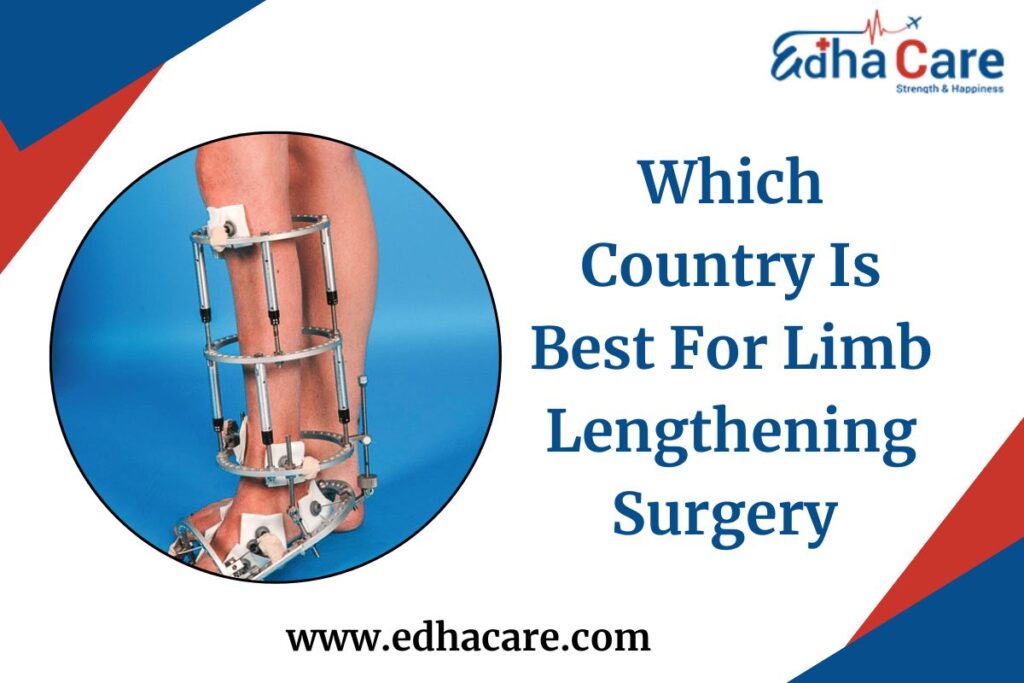 Quaenam Patria Optima Est Pro Chirurgia Membrorum Extensionis?