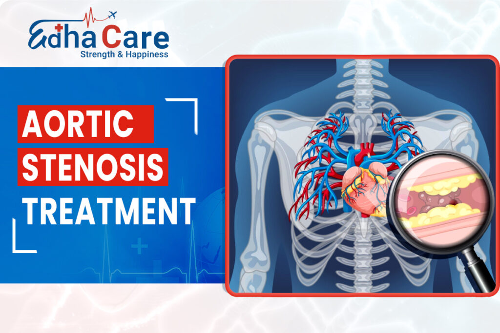What Are the Top 5 Advanced Aortic Stenosis Treatments?