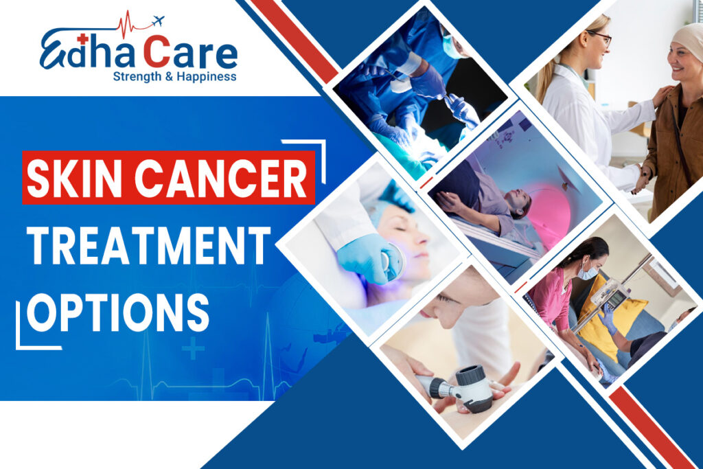Behandelingsopties voor huidkanker | EdhaCare