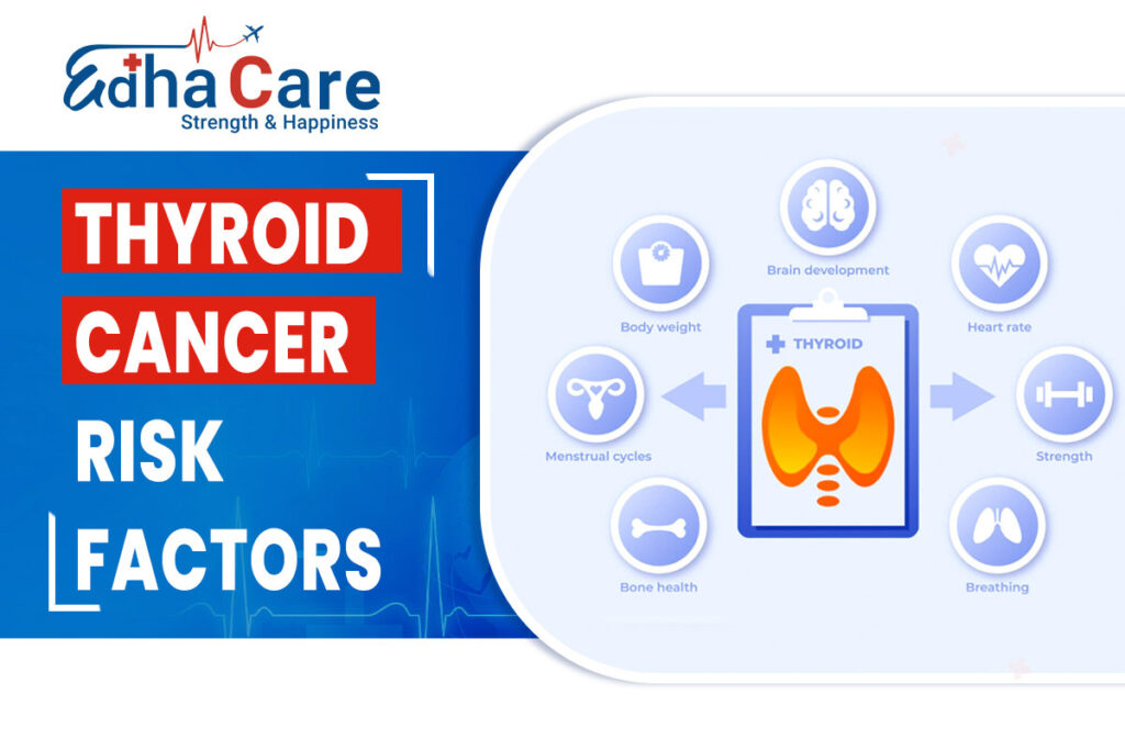 What Are the Leading Risk Factors for Thyroid Cancer?