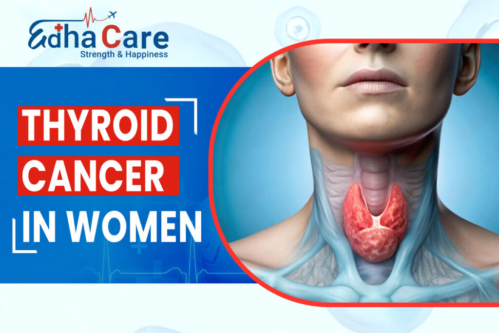 What Should Women Know About Thyroid Cancer Risks?