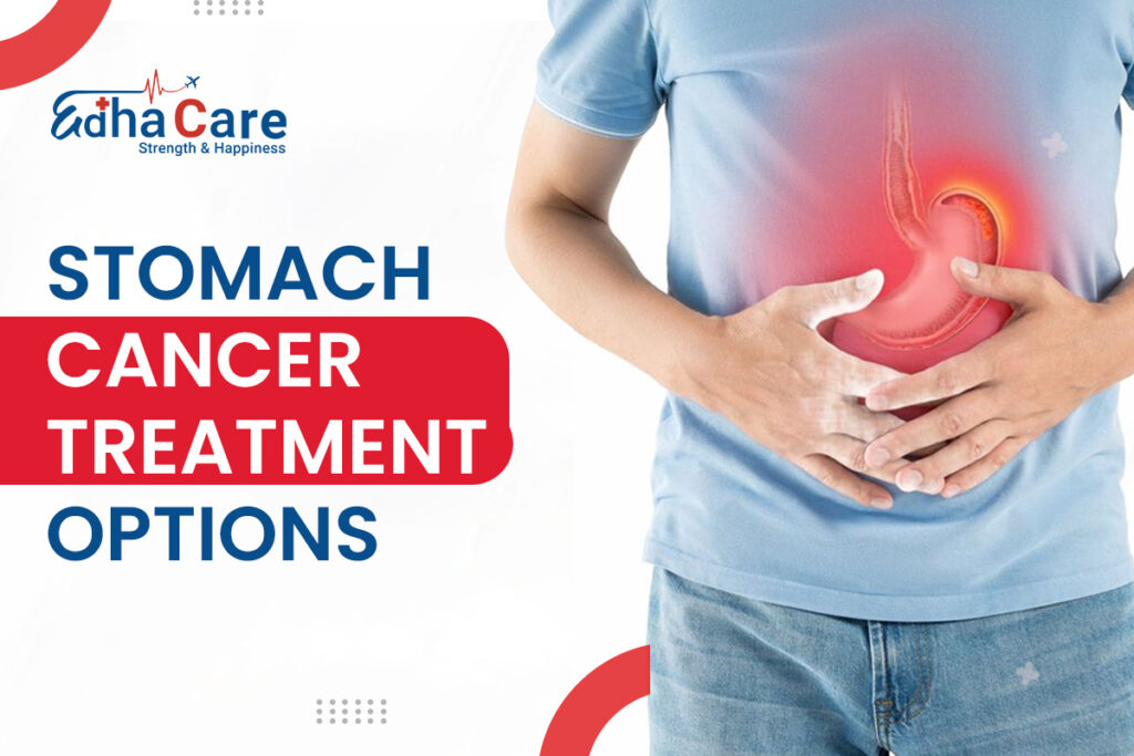 Quelles sont les meilleures options de traitement du cancer de l’estomac