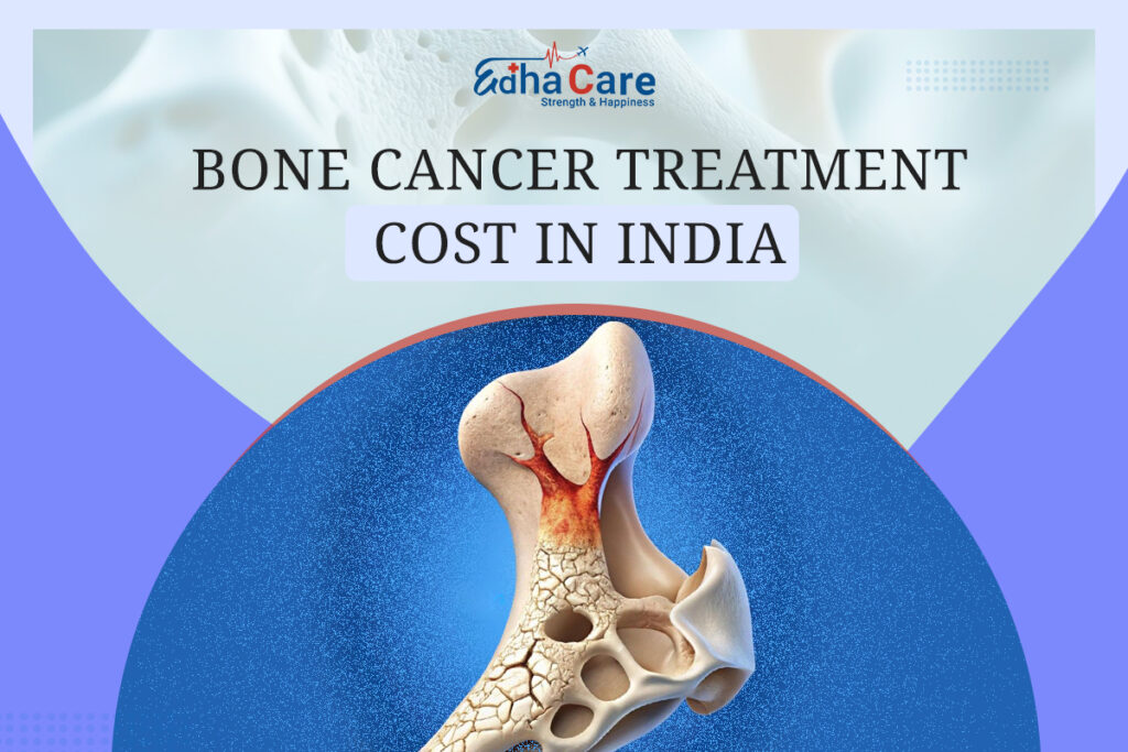 Sumptus Curationis Cancri Ossium in India - Sarcinae Curationis