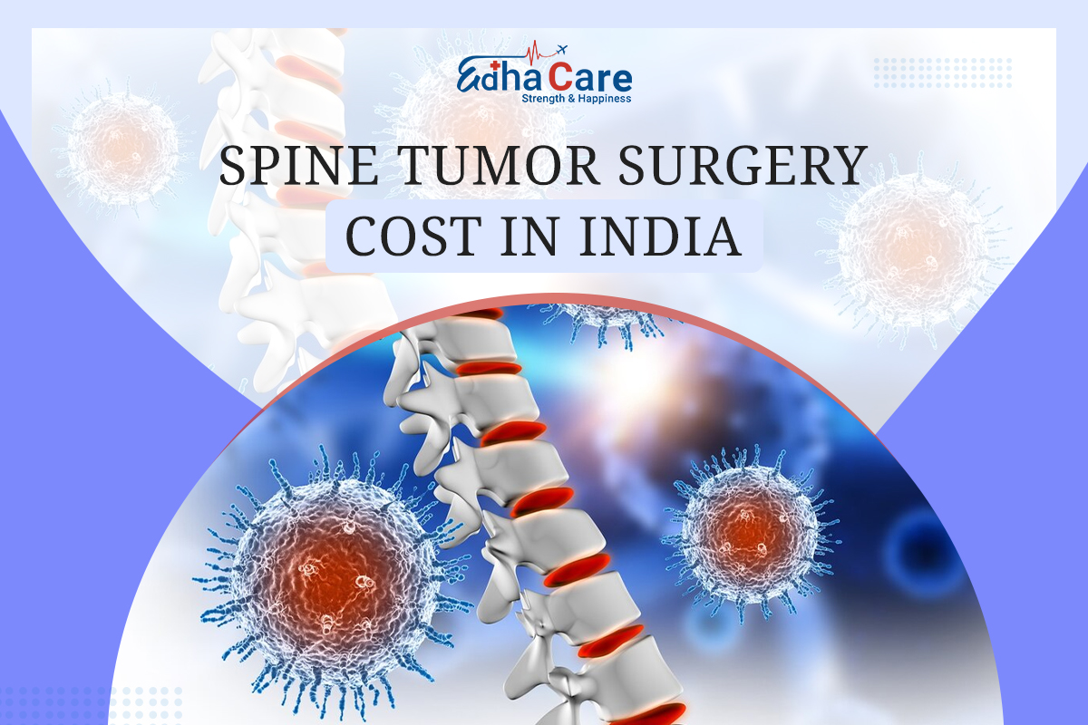 Chirurgie d'élimination des calculs vésicaux en Inde | Causes et symptômes