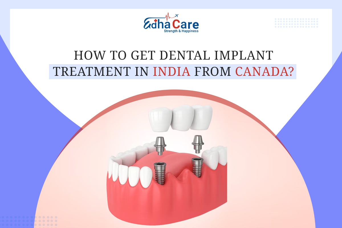 Cervical Conization | Cone Biopsy - Treatment Procedure, Risks & Benefits