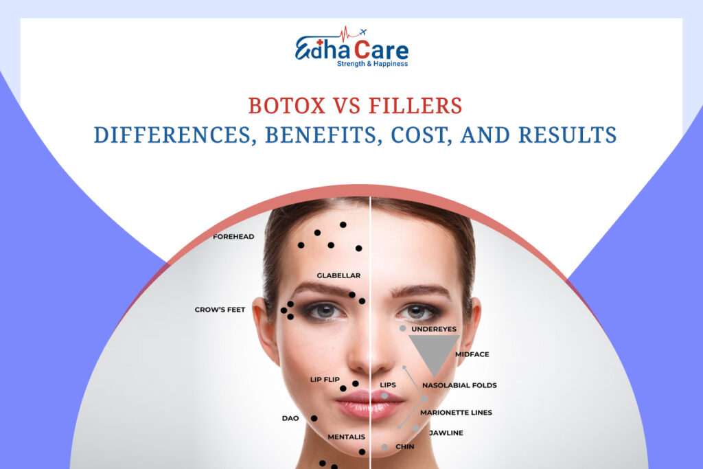 I-Botox vs Fillers: Umahluko, Iingenelo, Iindleko, kunye neziphumo