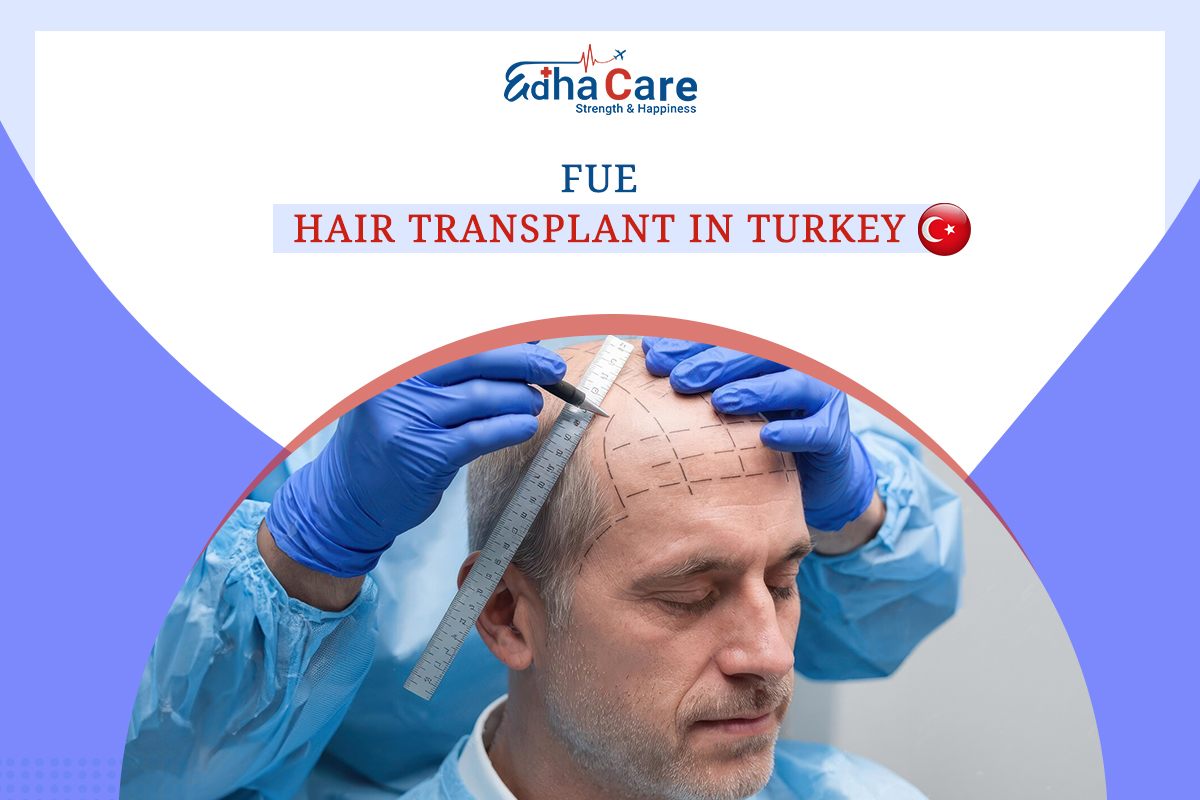 FUE Hair Transplant in Turkey: Natural Results & Fast Recovery