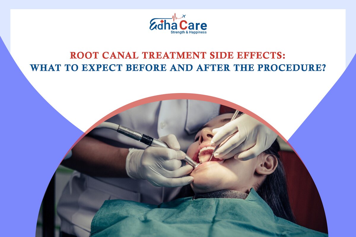 Root Canal Treatment Side Effects | Pain, Swelling & Recovery