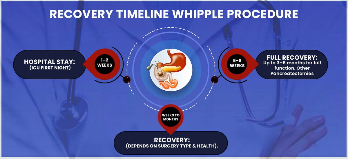 Chirurgie du cancer du pancréas en Inde | Traitement et coûts