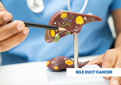 Bile Duct Cancer Treatment: Cost, Hospitals, Doctors | India