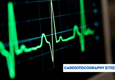 Cardiotocography (CTG) for Pregnancy : Treatment And Procedure