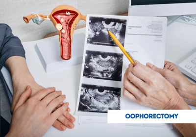 Ovariectomie | Chirurgie d'ablation des ovaires | EdhaCare