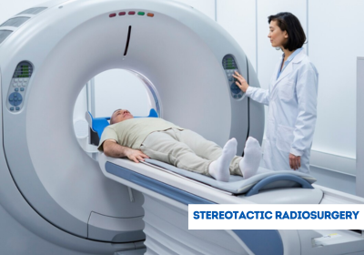 Stereotactic Radiosurgery | SRS Radiation | EdhaCare