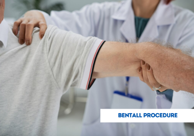Procedimento de Bentall: Custo da cirurgia, procedimento | Índia