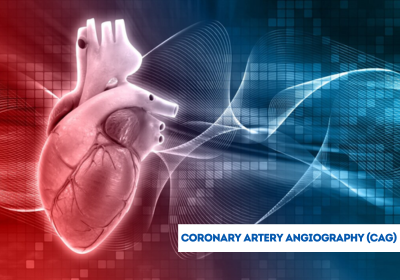 Angiografi Arteri Koroner (CAG) | Prosedur Angiogram Koroner | Edha ...