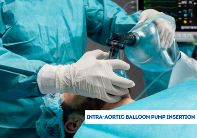 Intra-Aortic Balloon Pump Insertion: Cost, Symptoms | India