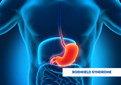 Roemheld Syndrome Treatment | Roemheld Syndrome Surgery | EdhaCare
