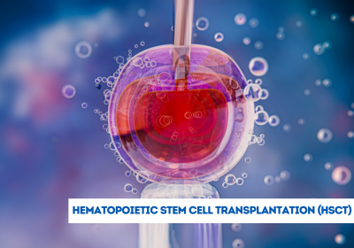 Hematopoietic Stem Cell Transplantation (HSCT) | Treatment