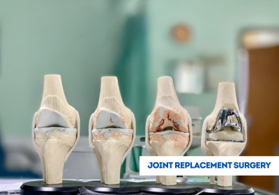 Joint Replacement Surgery: Procedure & Surgery Cost | India