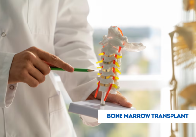 Bone Marrow Transplant: Doctors & Best Hospitals | India